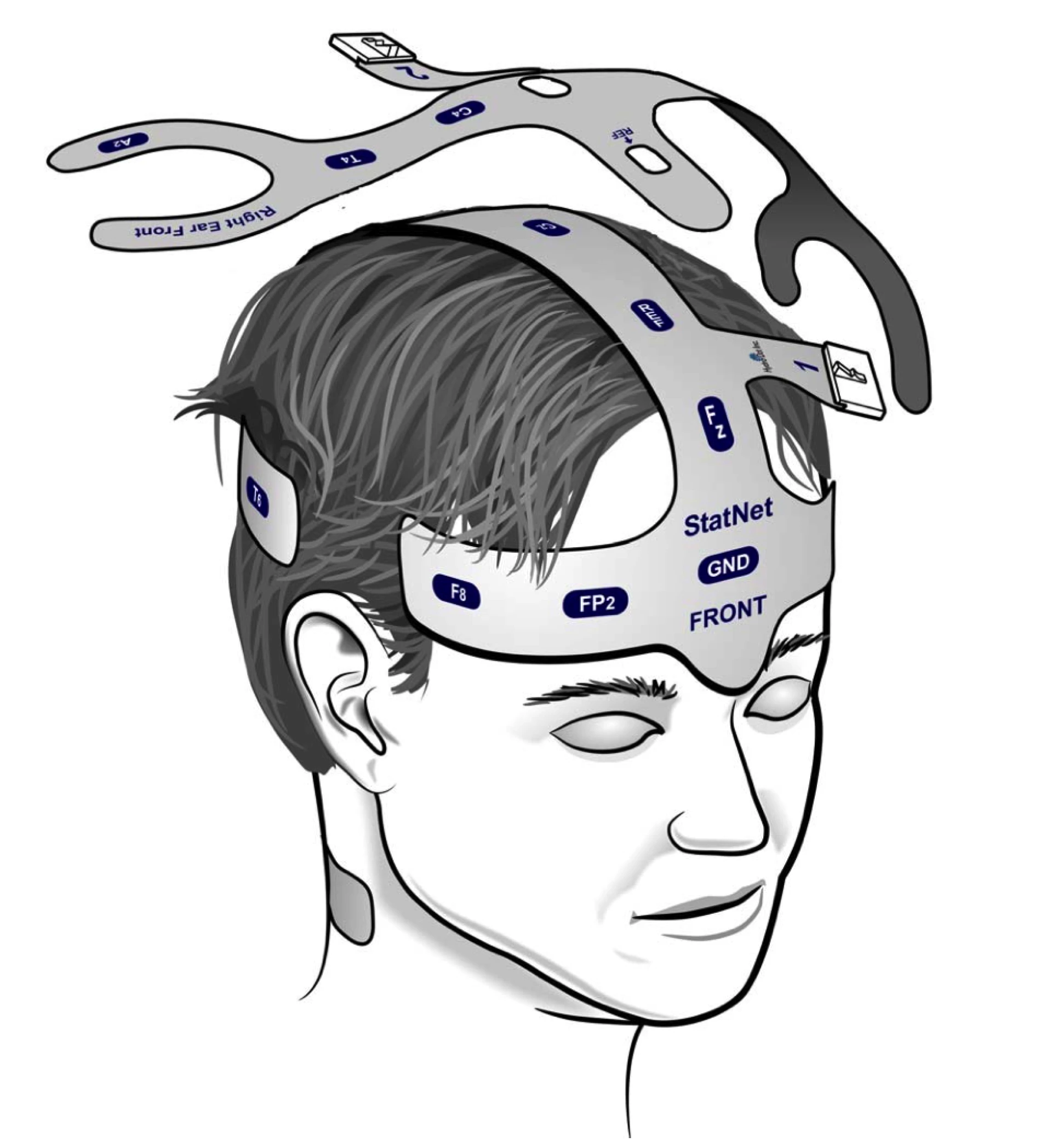 StatNet brings EEG into the 21st Century