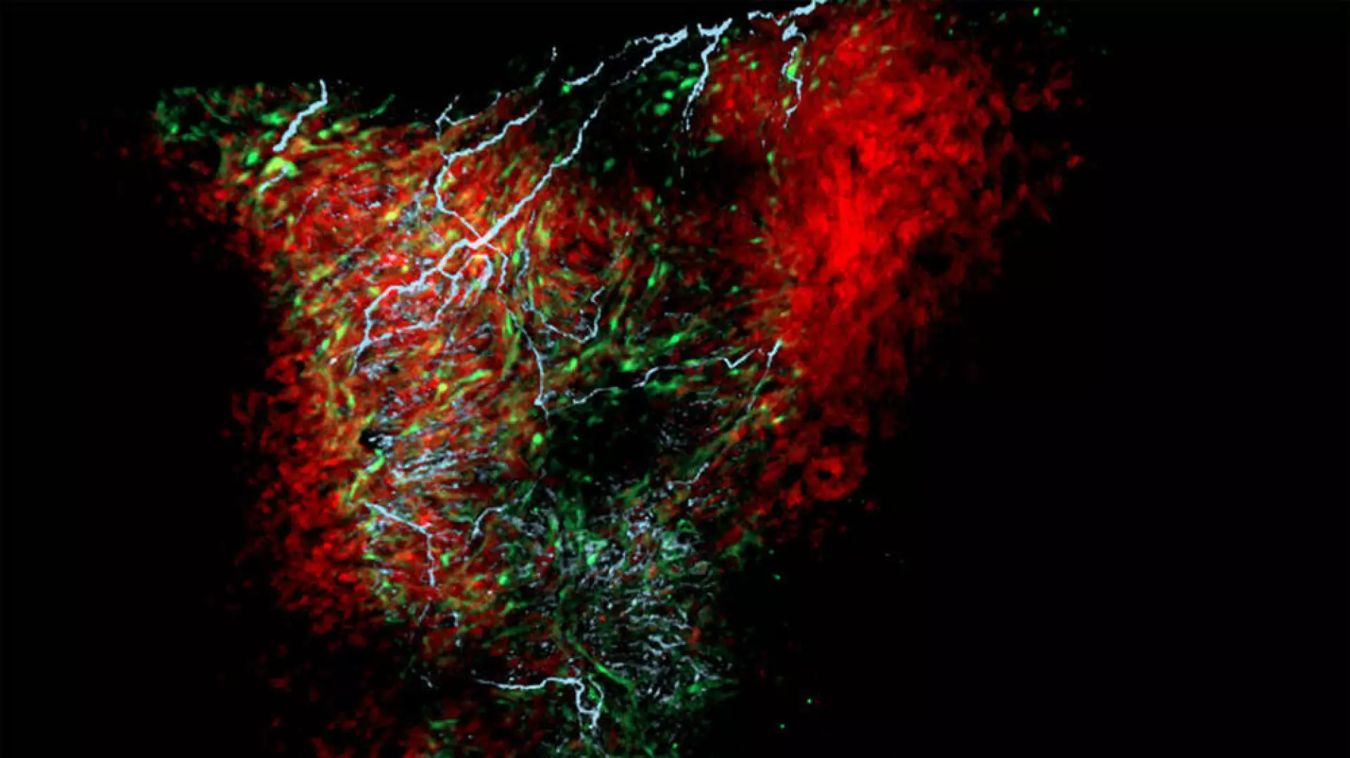 New cells discovered in the heart may regulate heart rate and rhythm