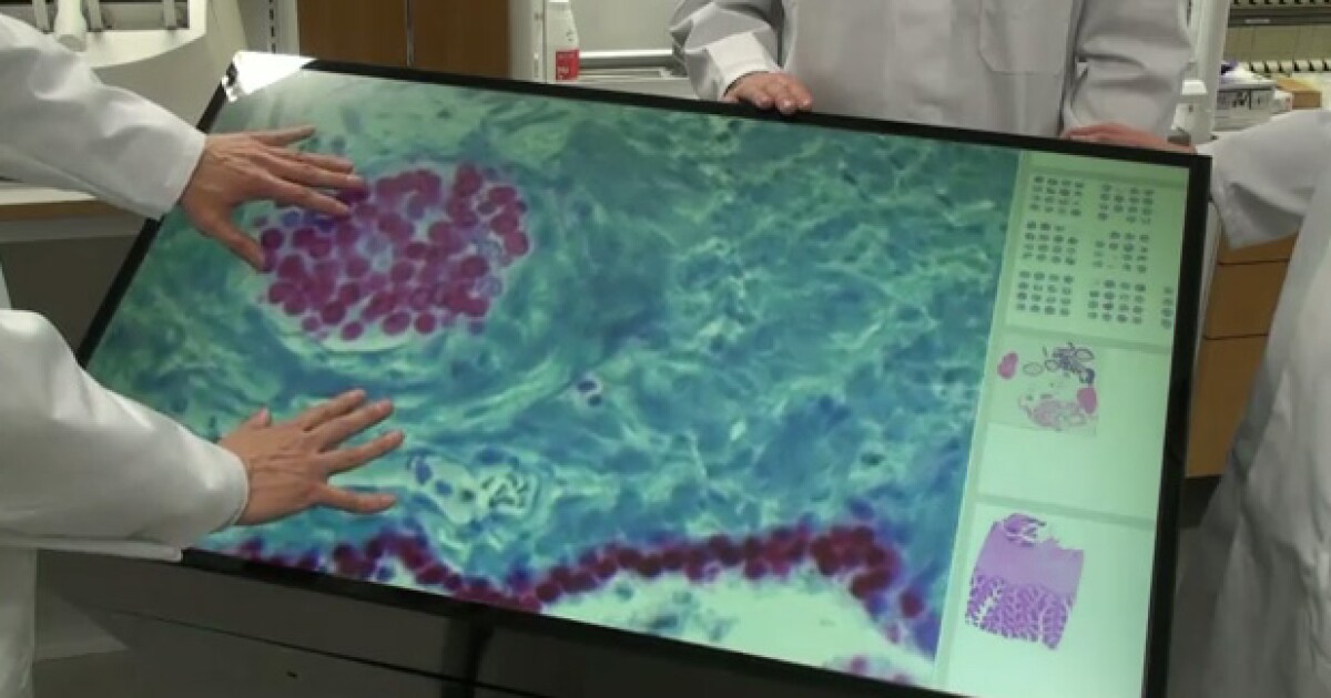 Multitouch gesture controlled microscope - the 'iPad on steroids'
