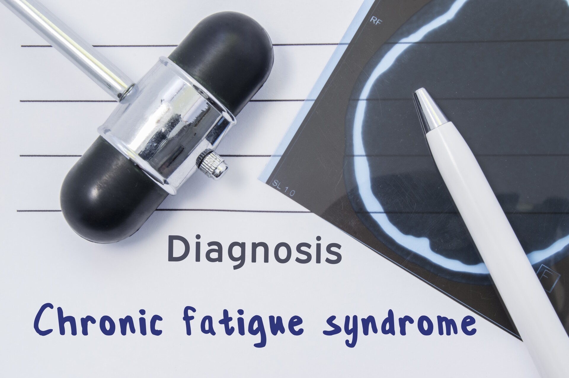 New Evidence Affirms Link Between Long COVID And Chronic Fatigue Syndrome new-evidence-affirms-link-between-long-covid-and-chronic-fatigue-syndrome
