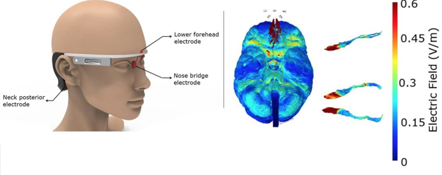 Google-Glass-like smell stimulation device proposed as dementia therapy
