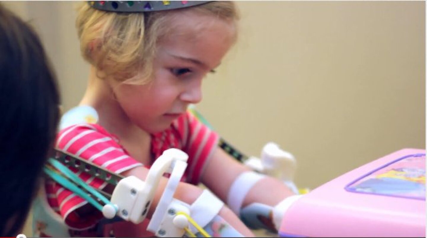 3D printed robotic exoskeleton gives young girl a helping hand