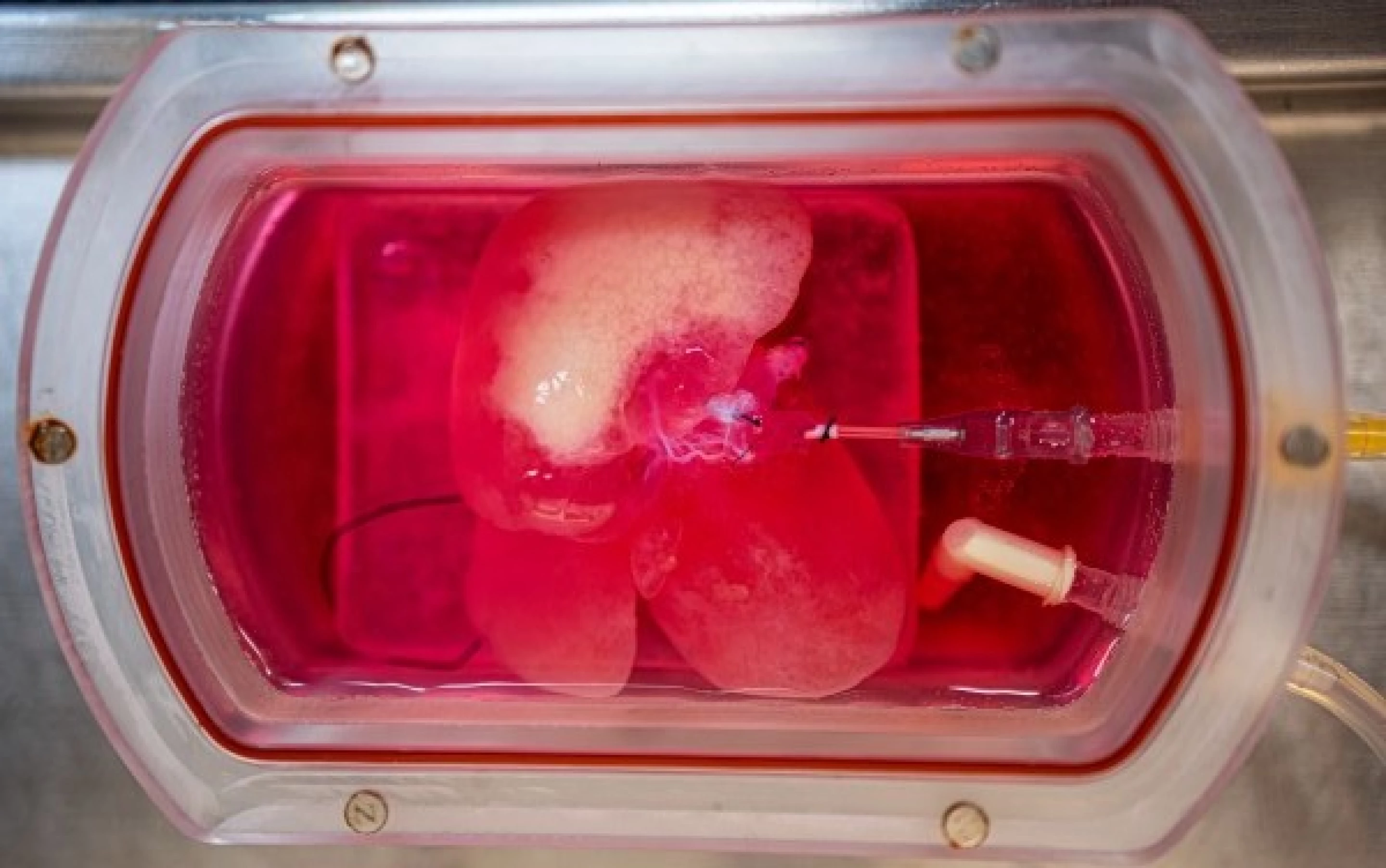 Mini human livers grown from stem cells successfully implanted in rats