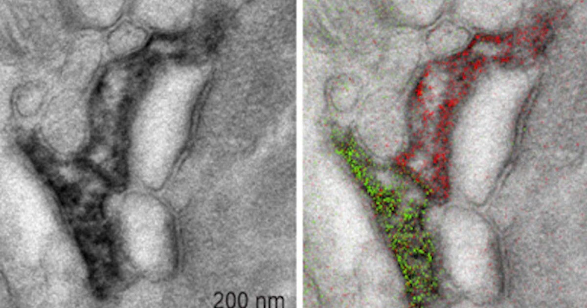 electron microscope color