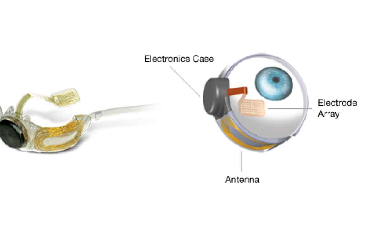 bionic eye technology