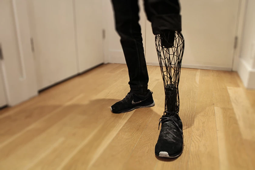3D printed Exo-Prosthetic leg designed to be affordable – and beautiful