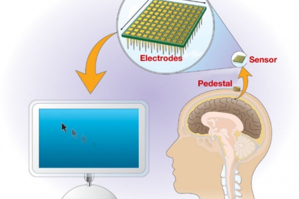 'BrainGate' Brain-Machine-Interface takes shape